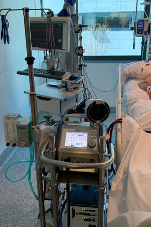 Así es el ECMO, la máquina que 'resucita' personas y órganos